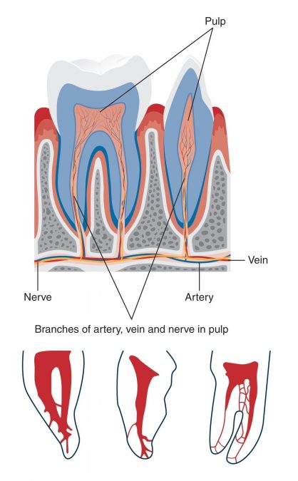 Root Canal Treatment - Holistic Approach | Sydney Holistic Dental Centre